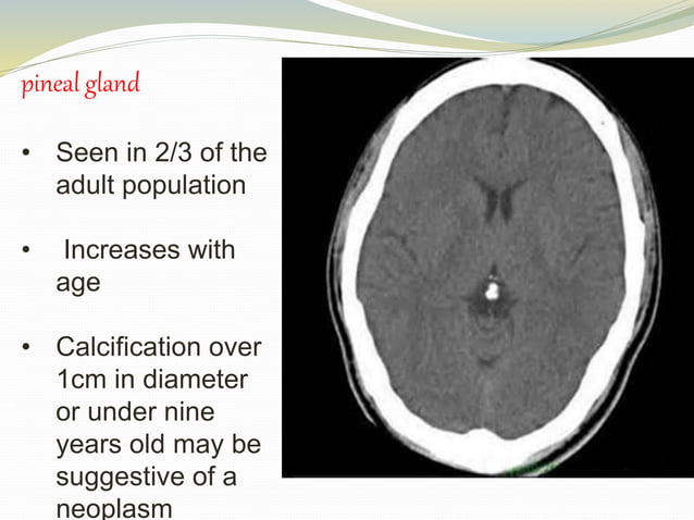 PHYSIOLOGICAL AND PATHOLOGICAL CALCIFICATION OF BRAIN | PPTX