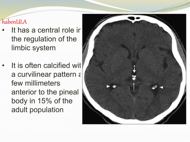 PHYSIOLOGICAL AND PATHOLOGICAL CALCIFICATION OF BRAIN | PPTX