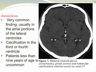 PHYSIOLOGICAL AND PATHOLOGICAL CALCIFICATION OF BRAIN | PPTX