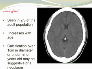 Causes Of Brain Calcification