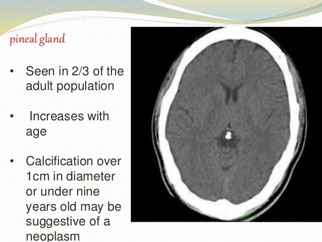 Physiological And Pathological Calcification Of Brain