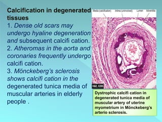 Calcification.pptx