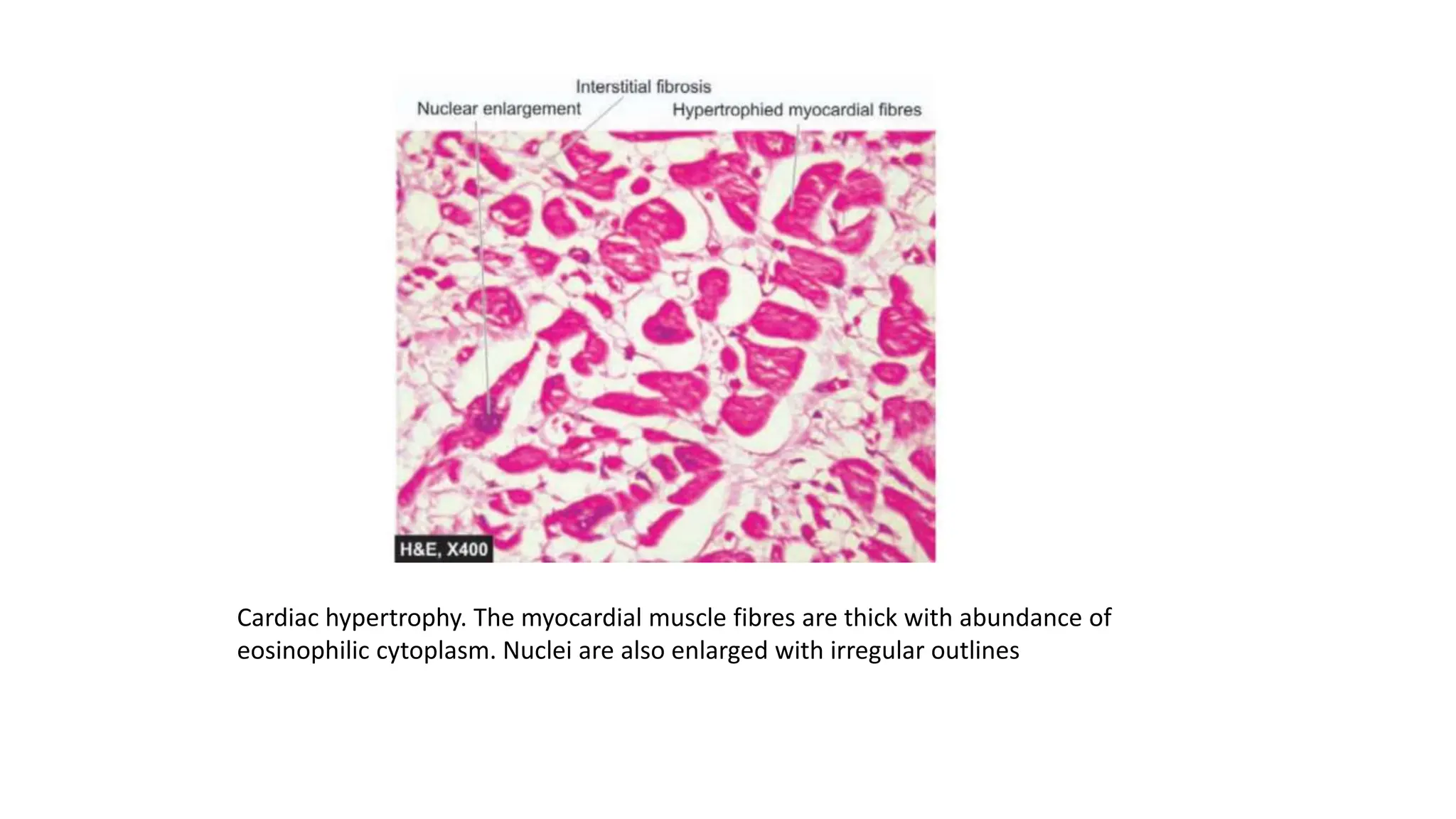 types of Calcifications in pathology.pptx