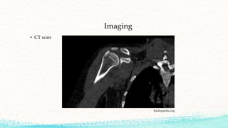 Calcific Tendinitis of the Rotator Cuff | PPTX