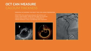 Calcified Lesions.pptx complex angioplasty | PPTX
