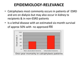 Calciphylaxis | PPTX