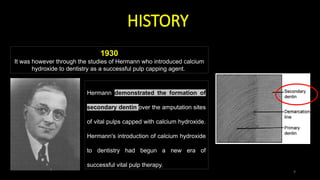 Calcium Hydroxide applications in Dentistry | PPTX