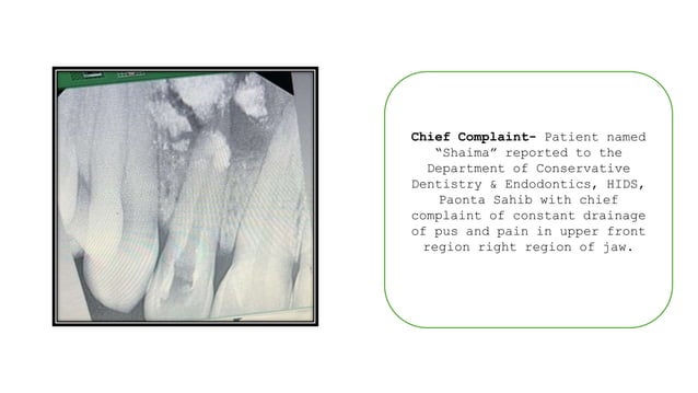 CALCIUM HYDROXIDE EXTRUSION..........pptx
