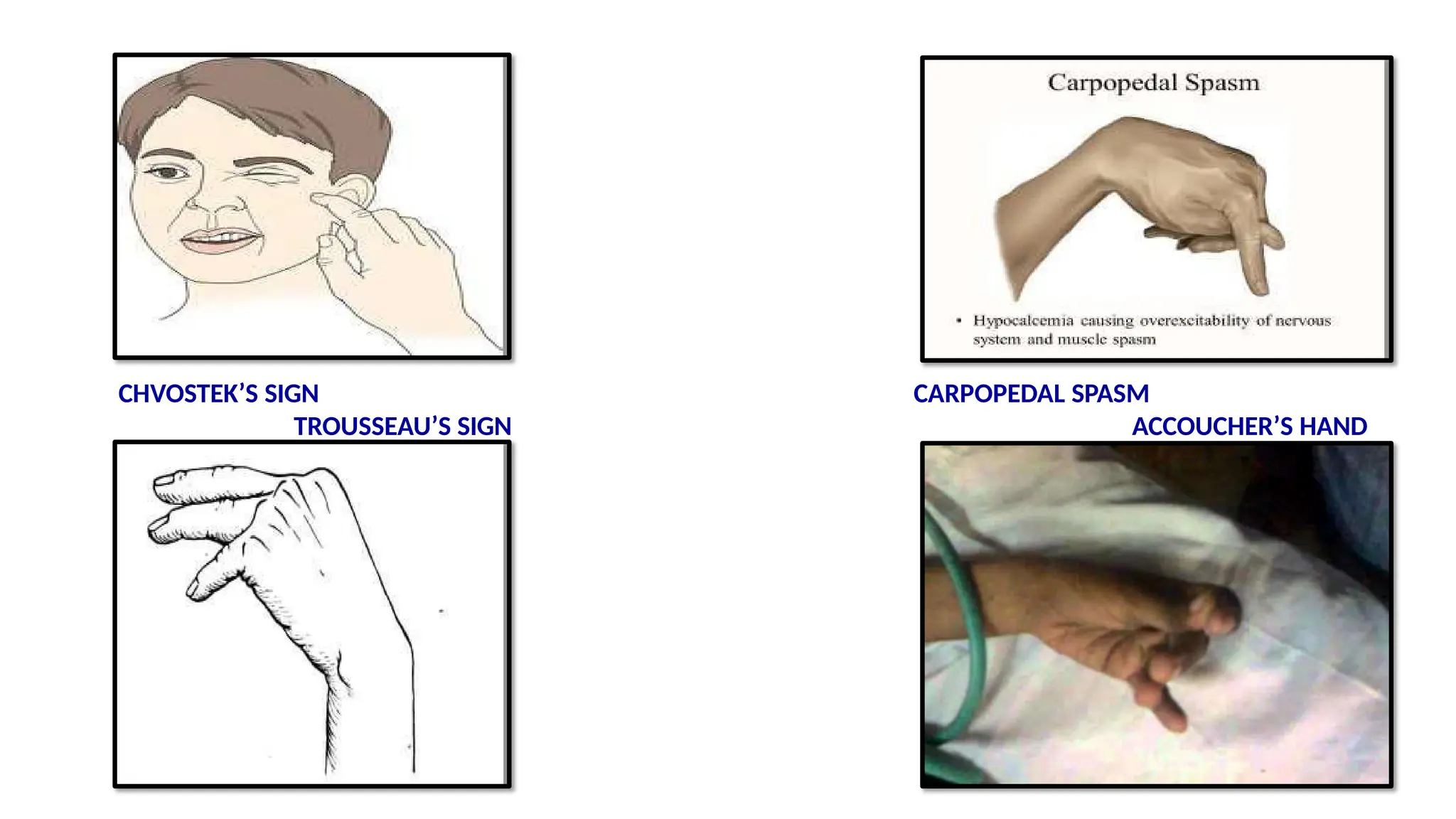 CALCIUM METABOLISM - its importance in orthodontics | PPTX