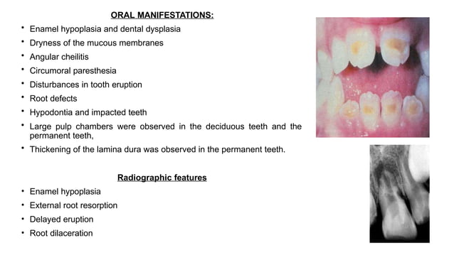 CALCIUM METABOLISM - its importance in orthodontics | PPTX | Endocrine ...