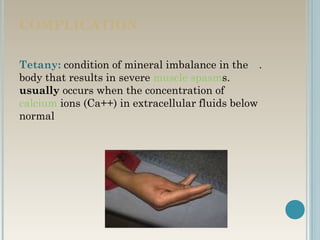 Calcium metabolism disorders | PPT
