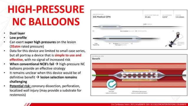 CALCIUM MODIFICATION TECHNIQUES IN COMPLEX PCI | PDF | Heart and ...