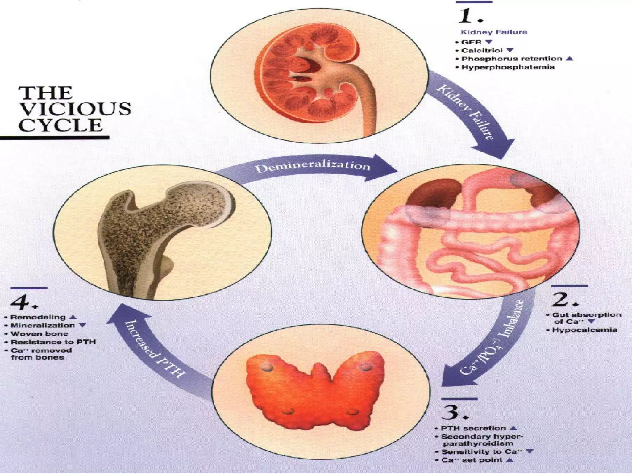 Calcium & phosphorus in ckd (2) | PPTX