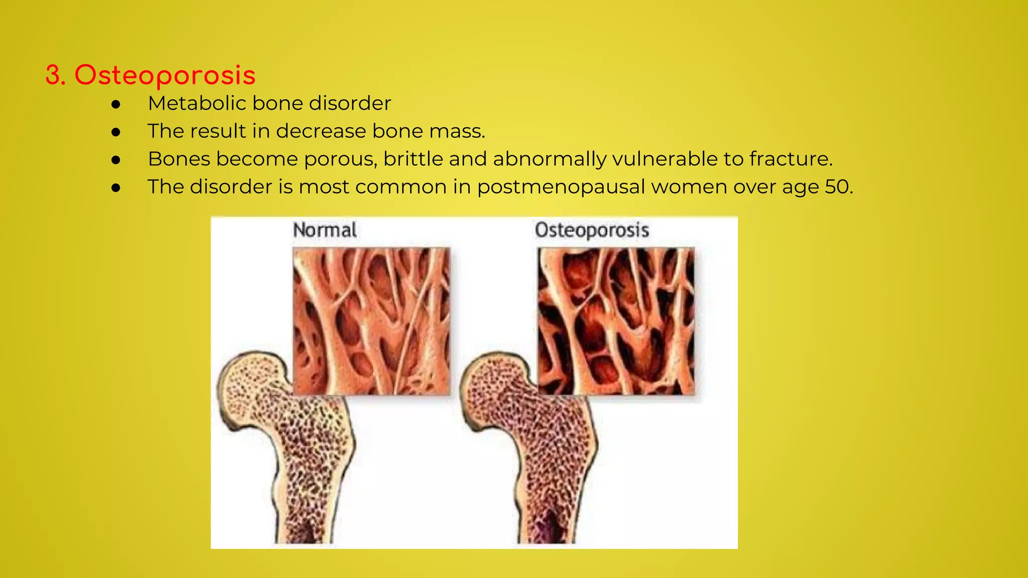 Calcium, phosphorus, potassium | PDF | Bone and Joint Conditions ...
