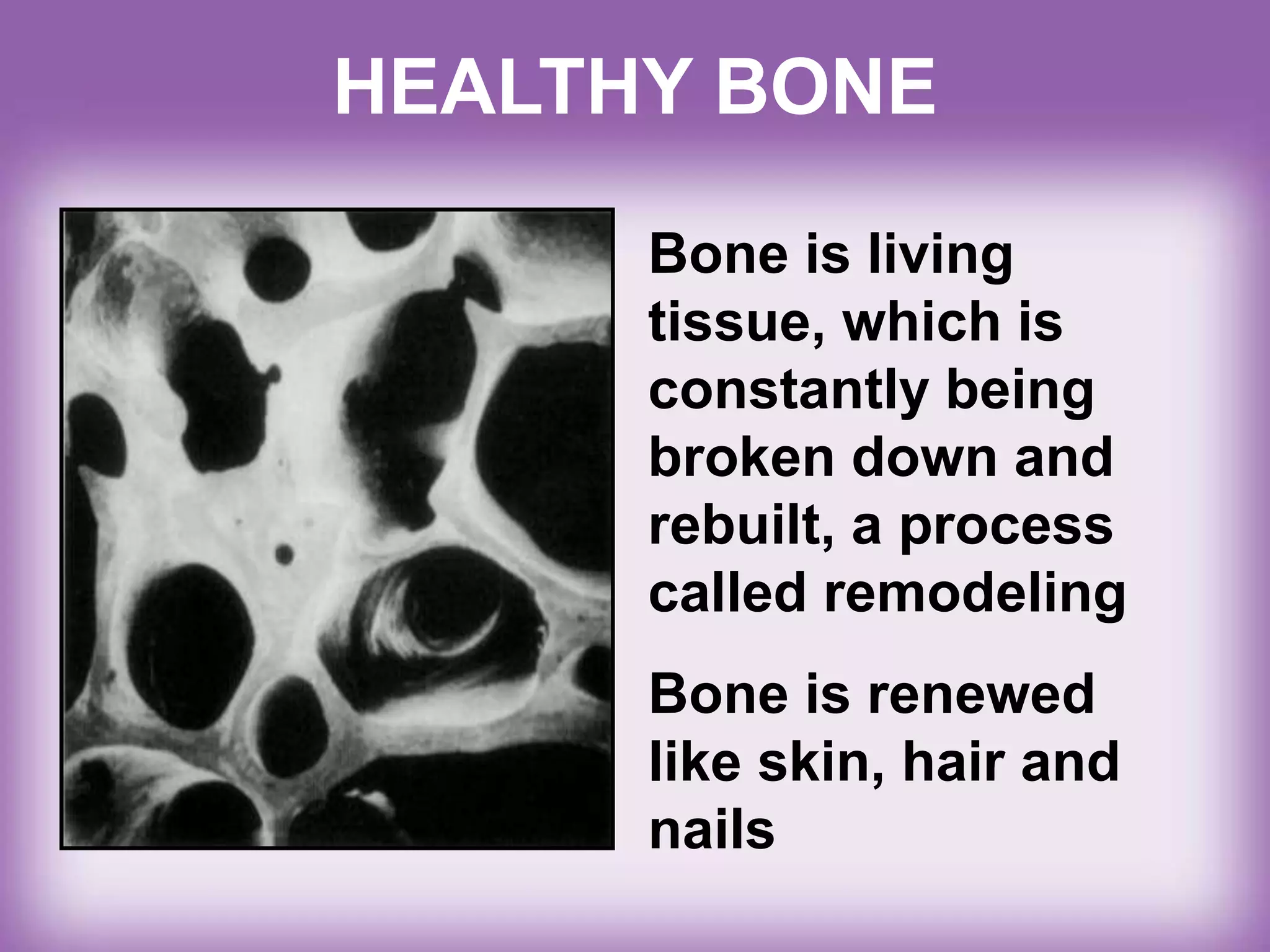 Calcium Presentation-revised.ppt