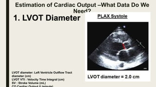 Hemodynamic Echocardiography Calculation.pptx