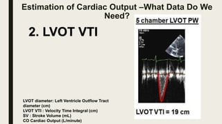 Hemodynamic Echocardiography Calculation.pptx