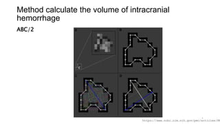 Calculate the volume of Intracranial Hemorrhage.pptx