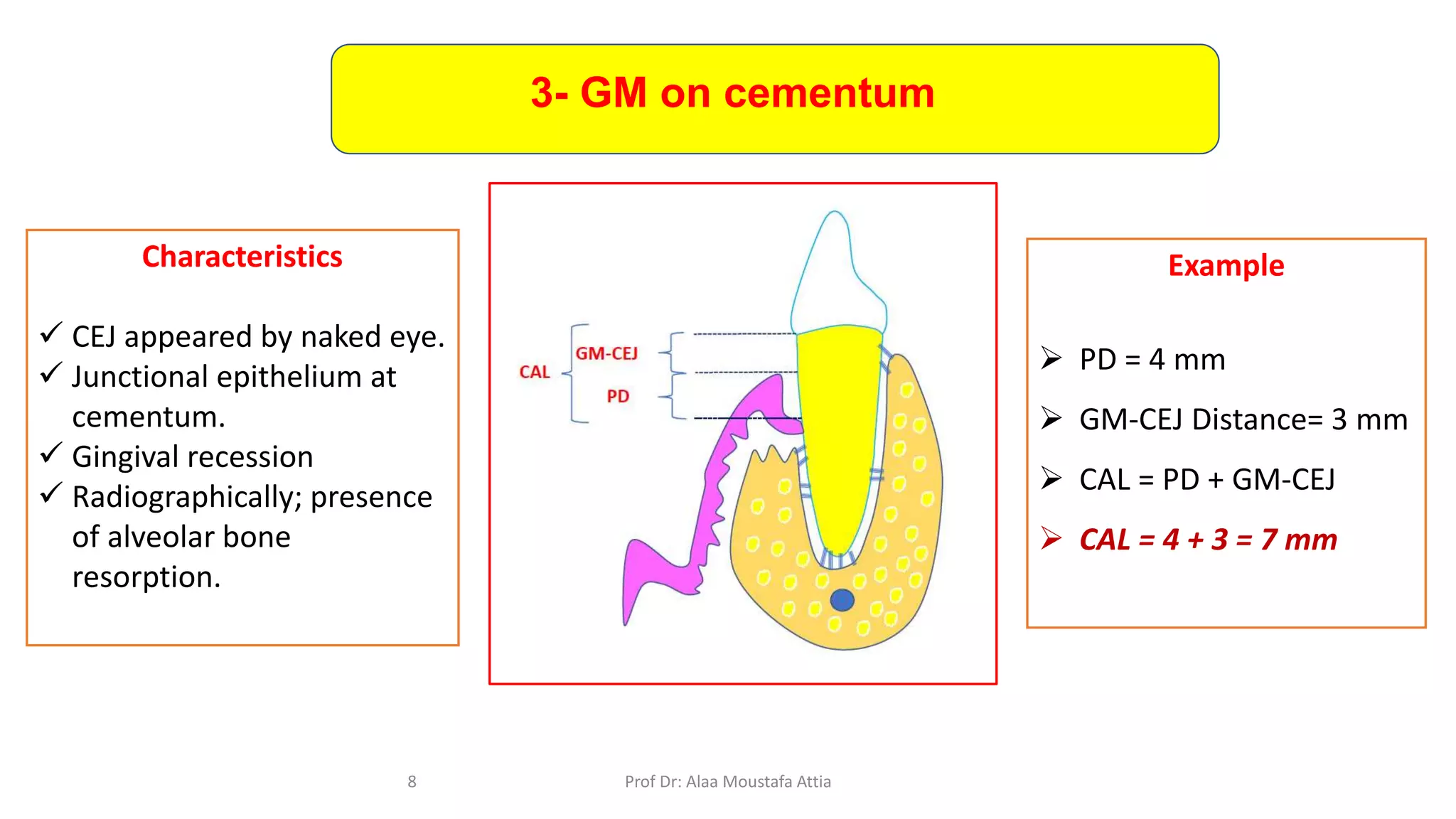 Calculation of clinical attachment level (cal), Prof Dr: Alaa Moustafa ...
