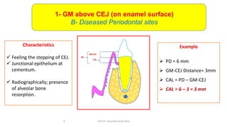 Calculation of clinical attachment level (cal), Prof Dr: Alaa Moustafa ...