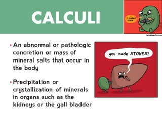 Calculi Formation | PDF