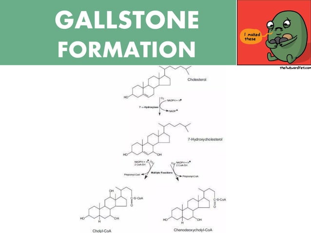 Calculi Formation | PPT