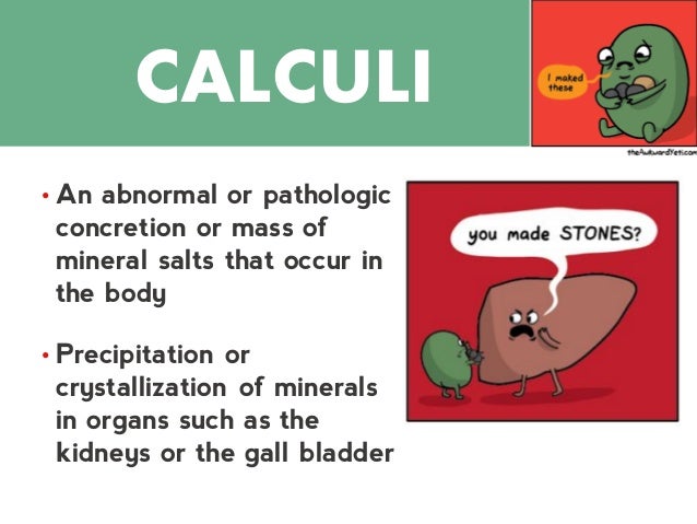 Calculi Formation