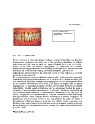 Calculo dental | DOCX