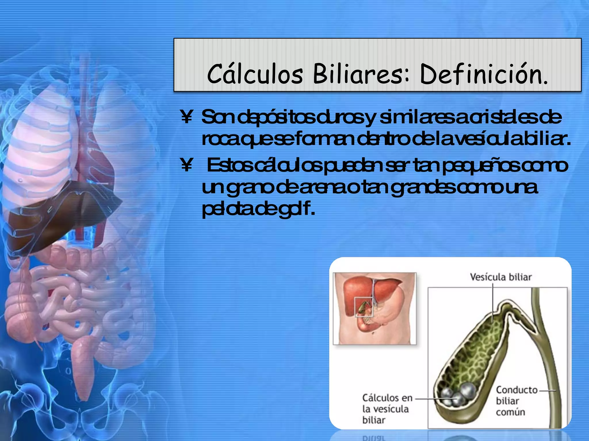 Calculos Biliares Y Calculos Renales | PPT