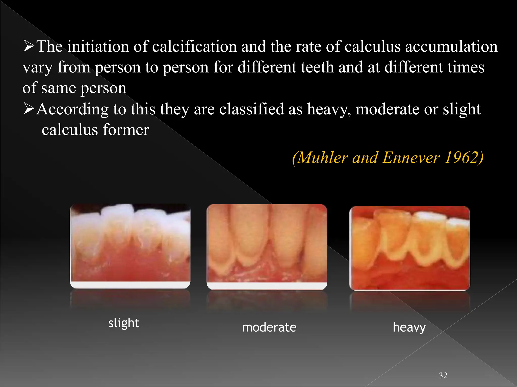 Calculus (Classification, composition, microbiology etc.pptx