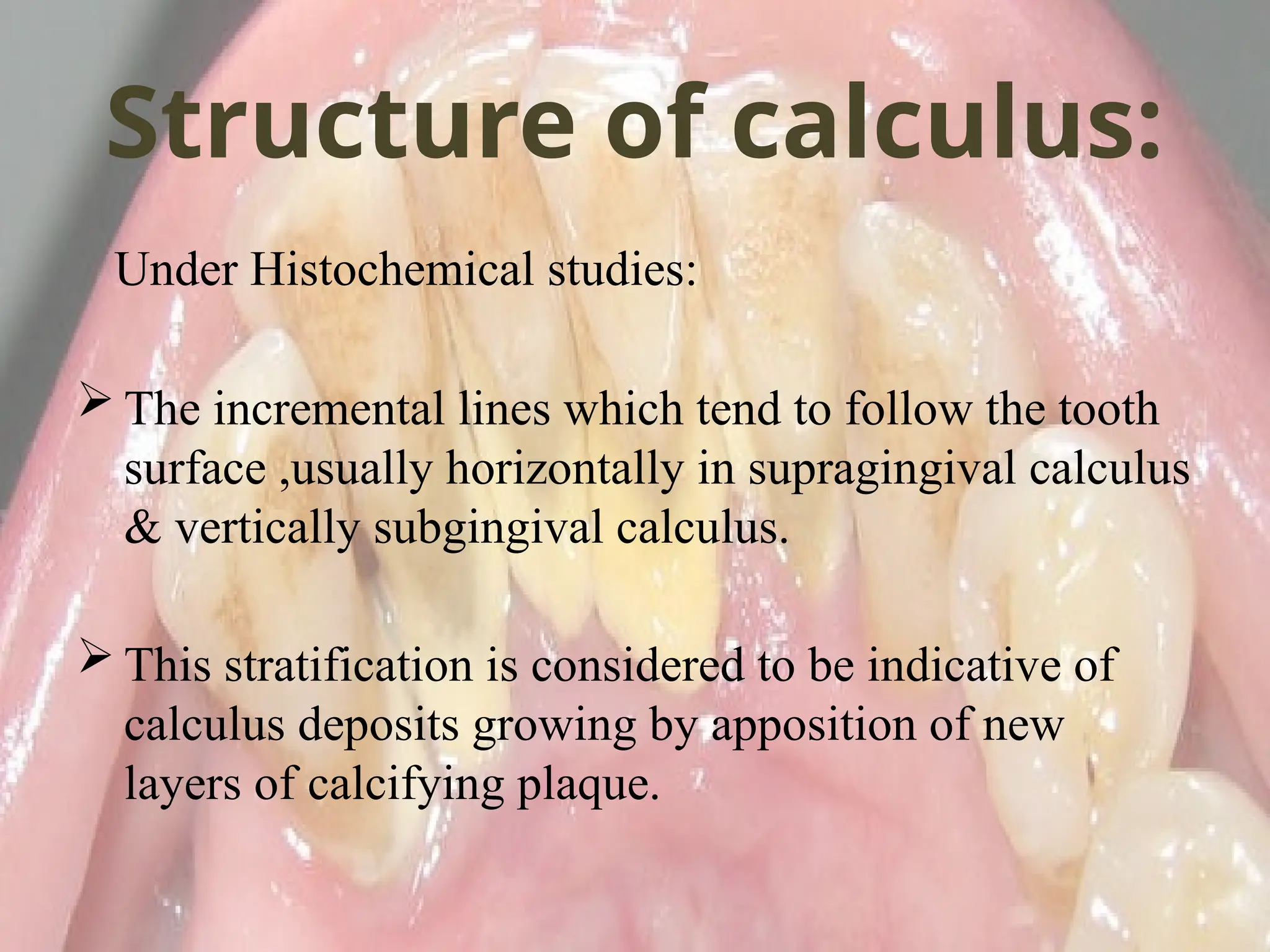 Calculus- Calcification of the plaque maturation | PPT