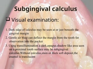 Calculus- Calcification of the plaque maturation | PPTX