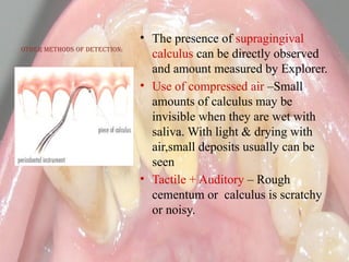 Calculus- Calcification of the plaque maturation | PPTX