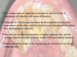 Calculus- Calcification of the plaque maturation | PPTX