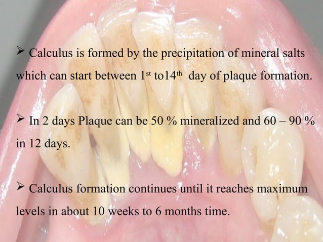Calculus- Calcification of the plaque maturation | PPT