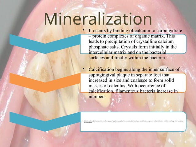 Calculus- Calcification of the plaque maturation | PPT