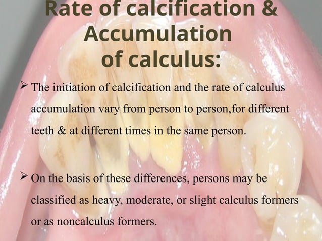 Calculus- Calcification of the plaque maturation | PPT