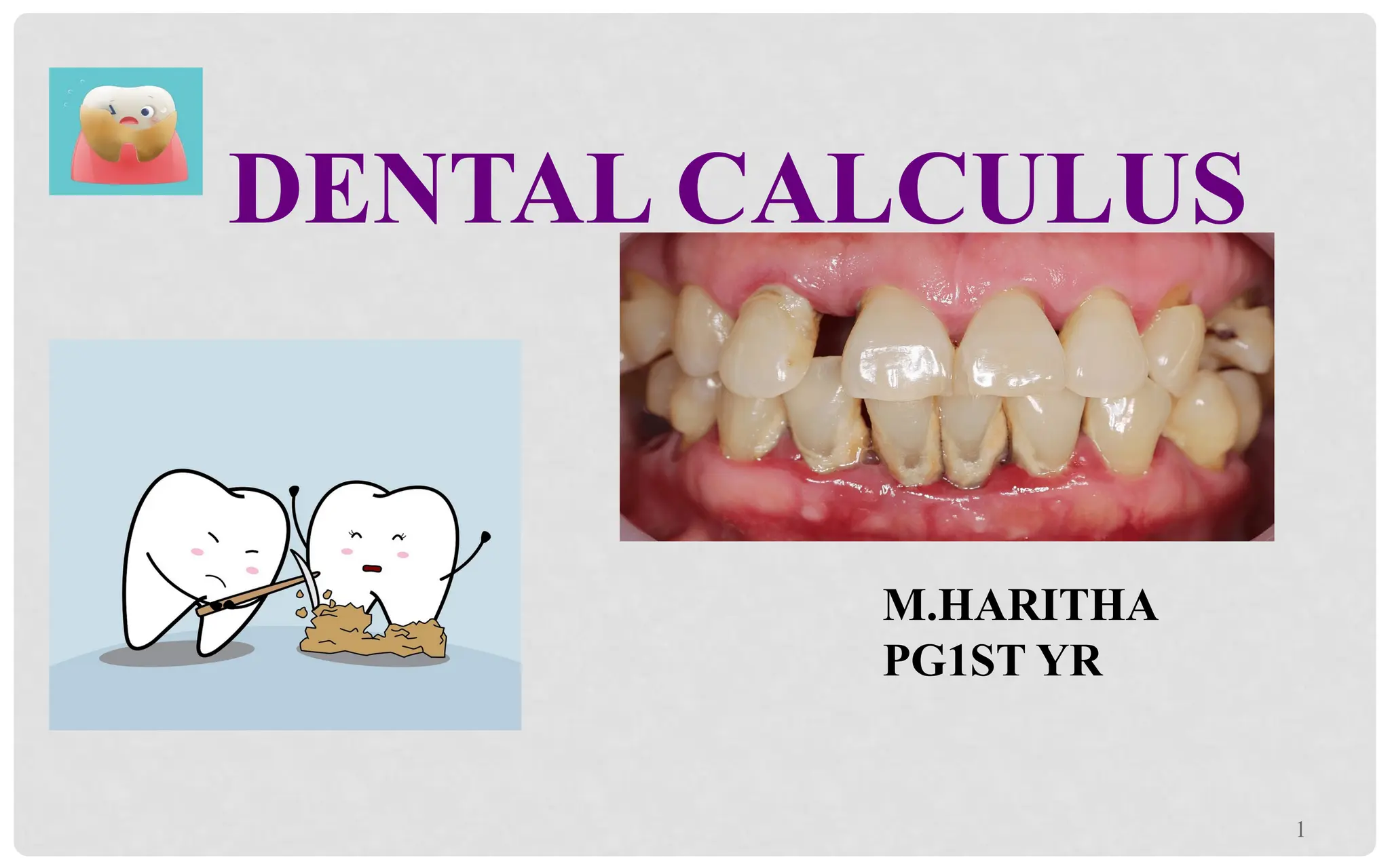 DENTAL CALCULUS power point presentation | PPTX