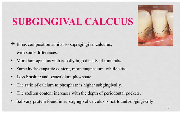 DENTAL CALCULUS power point presentation | PPTX | Dental Health ...