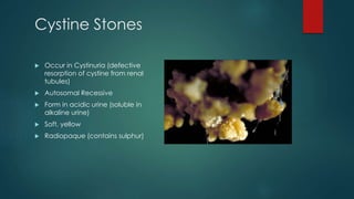 Calculus Disease Renal Stones Radiology | PPTX