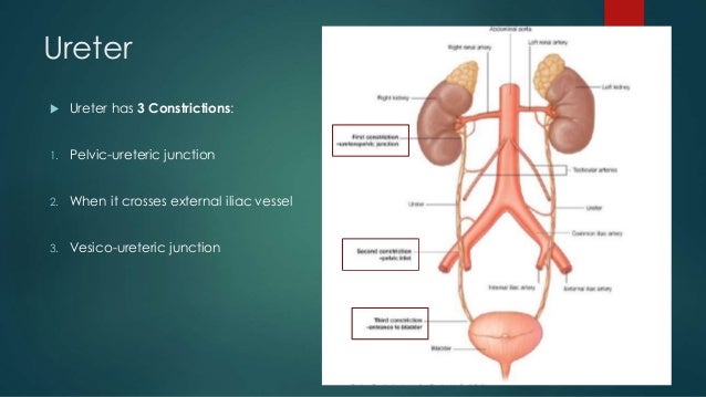 Calculus Disease Renal Stones Radiology