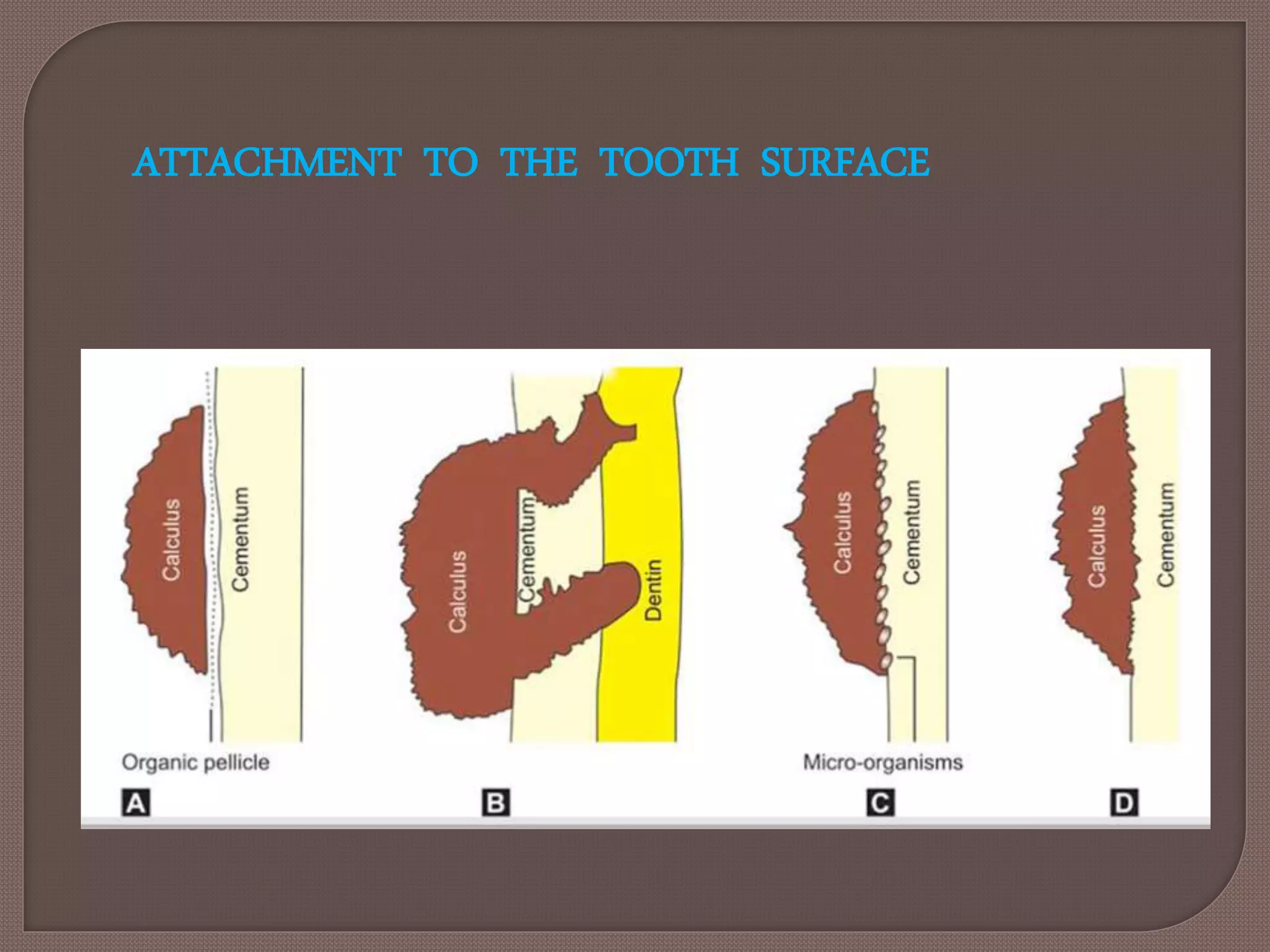 Dental Calculus ppt | PPTX
