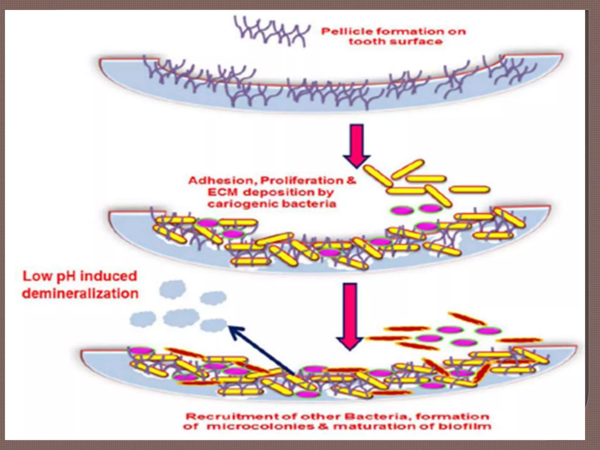 Dental Calculus ppt | PPTX