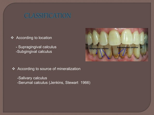 Dental Calculus ppt | PPTX