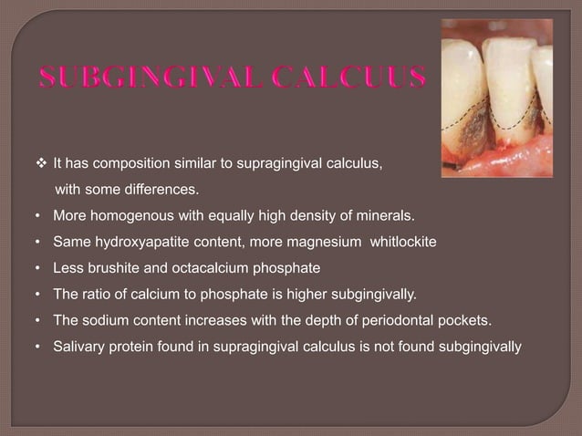 Dental Calculus ppt | PPTX