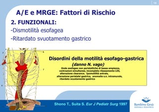 Atresia Esofagea - Stenosi e MRGE | PDF | Ear, Nose and Throat ...