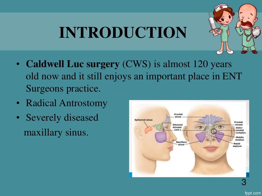 Caldwell luc surgery