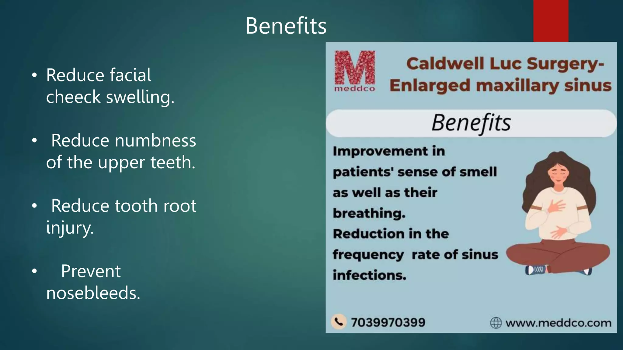Caldwell Luc surgery.pptx