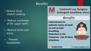 Caldwell Luc surgery.pptx