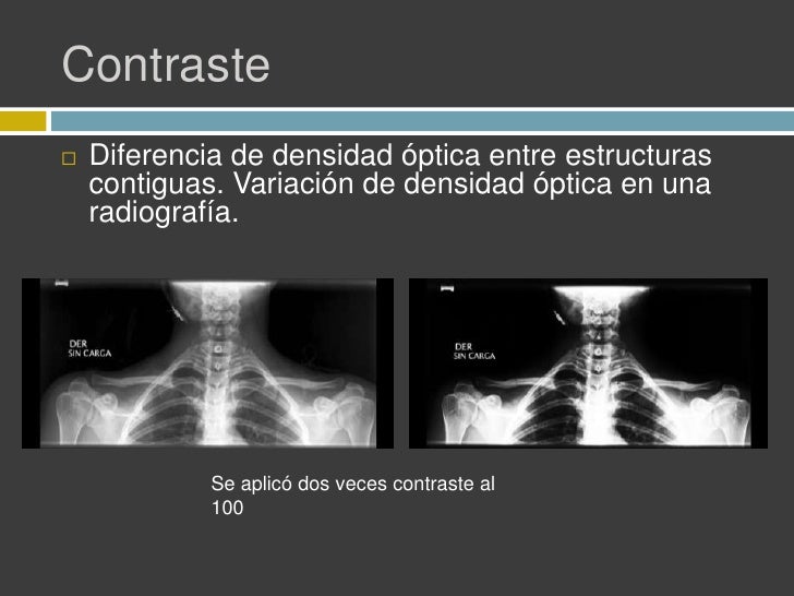 Calidad de imagen en radiología